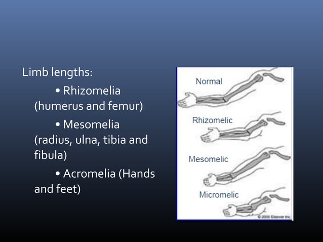 Approach to skeletal dysplasia | PPT | Bone and Joint Conditions ...