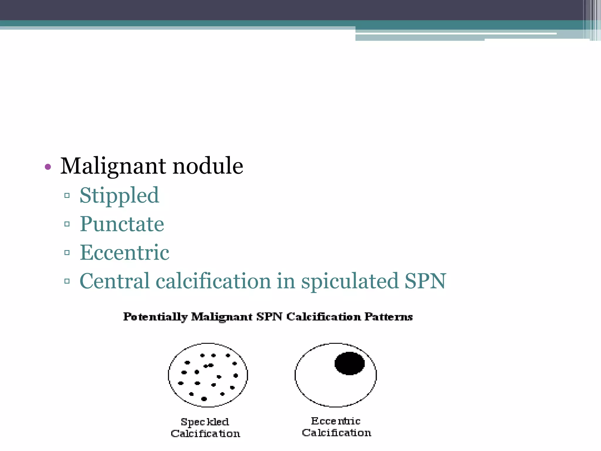 Approach to solitary pulmonary nodule | PPTX