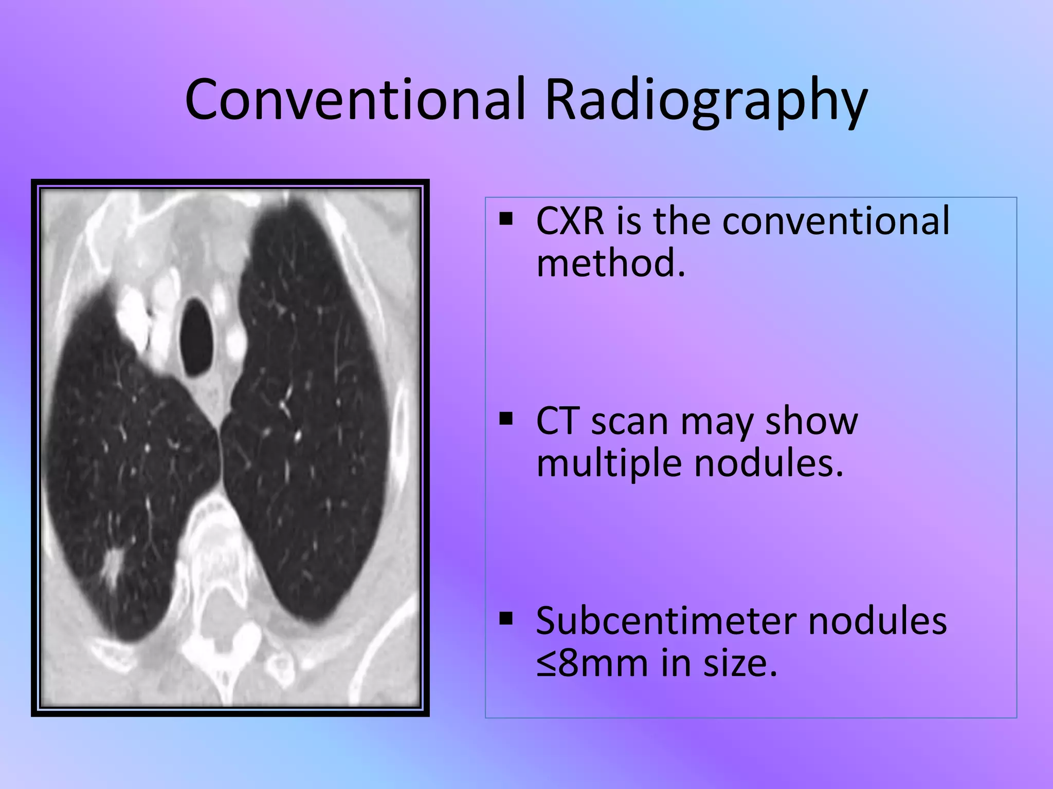 Approach to solitary pulmonary nodule | PPTX