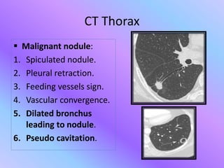 Approach to solitary pulmonary nodule | PPTX