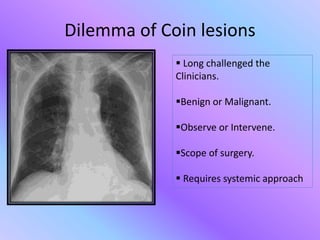 Approach to solitary pulmonary nodule | PPTX