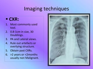 Approach to solitary pulmonary nodule | PPTX