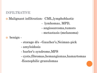 Approach to splenomegaly | PPTX