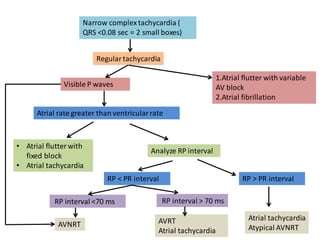 Approach to SVT ufhhchchchcjhcjfjjfuhf fhfhfufhu | PPT