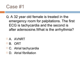 Supraventricular Tachycardia Treatment