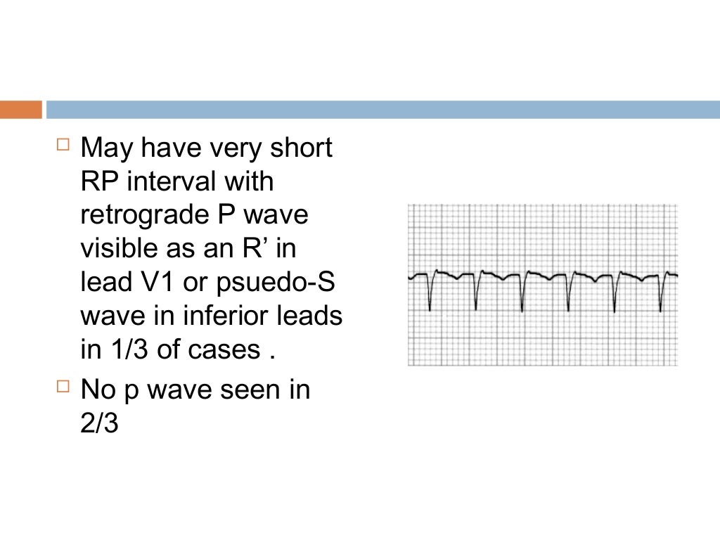 Approach to svt