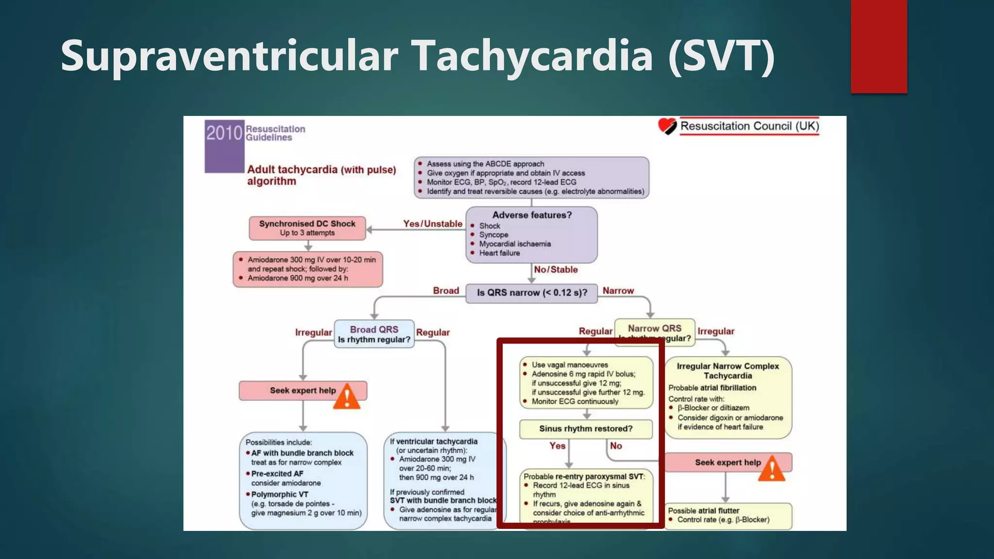 Approach to tachyarrhythmia | PPTX