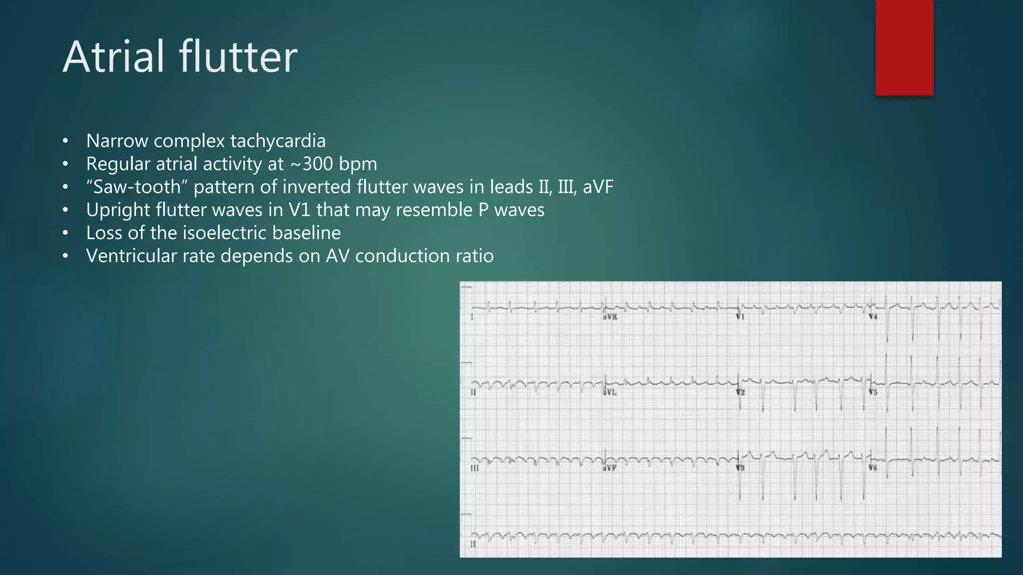 Approach to tachyarrhythmia | PPTX