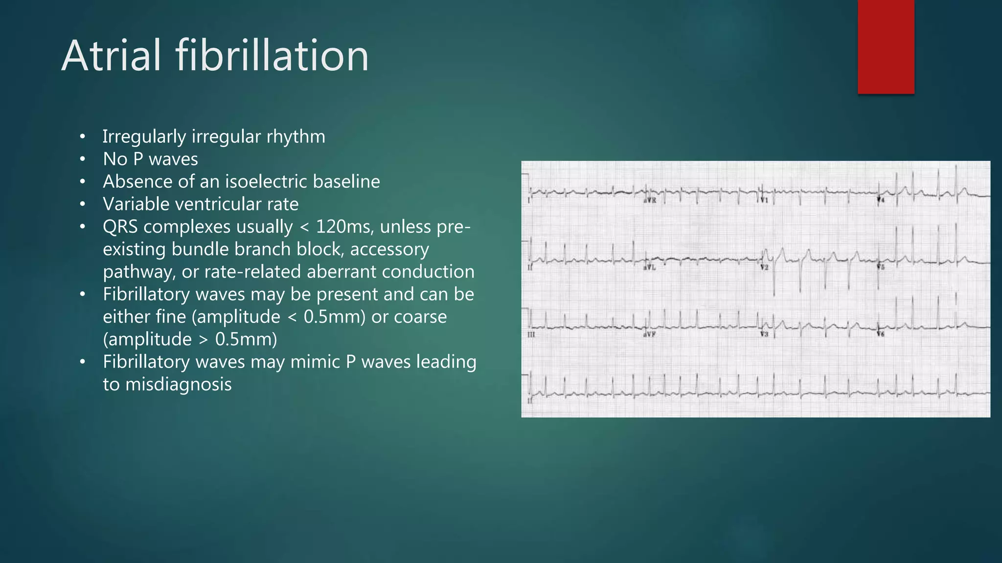 Approach to tachyarrhythmia | PPTX