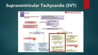 Approach to tachyarrhythmia | PPTX