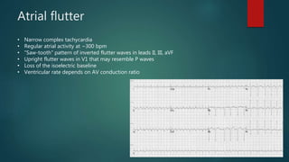 Approach to tachyarrhythmia | PPTX