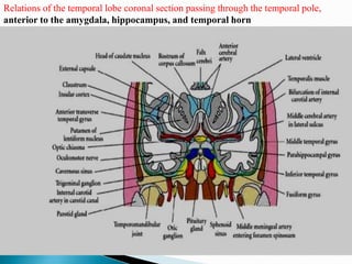Approach to temporal lobe anatomy,function,epilepsy MRI finding | PPTX