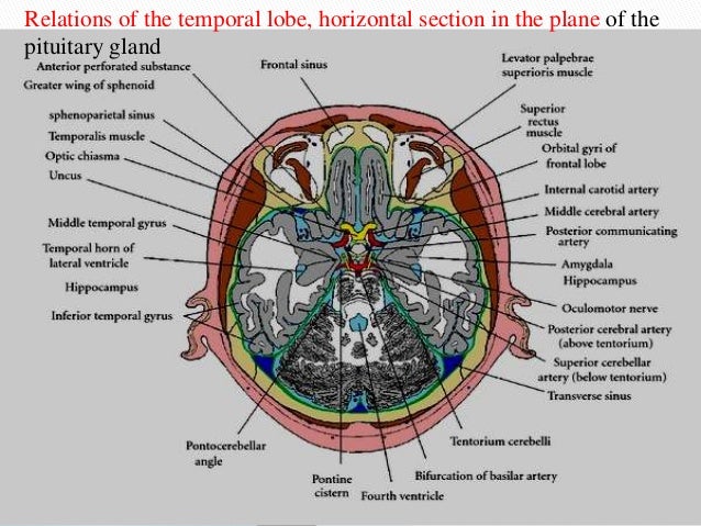 Approach to temporal lobe anatomy,function,epilepsy MRI finding