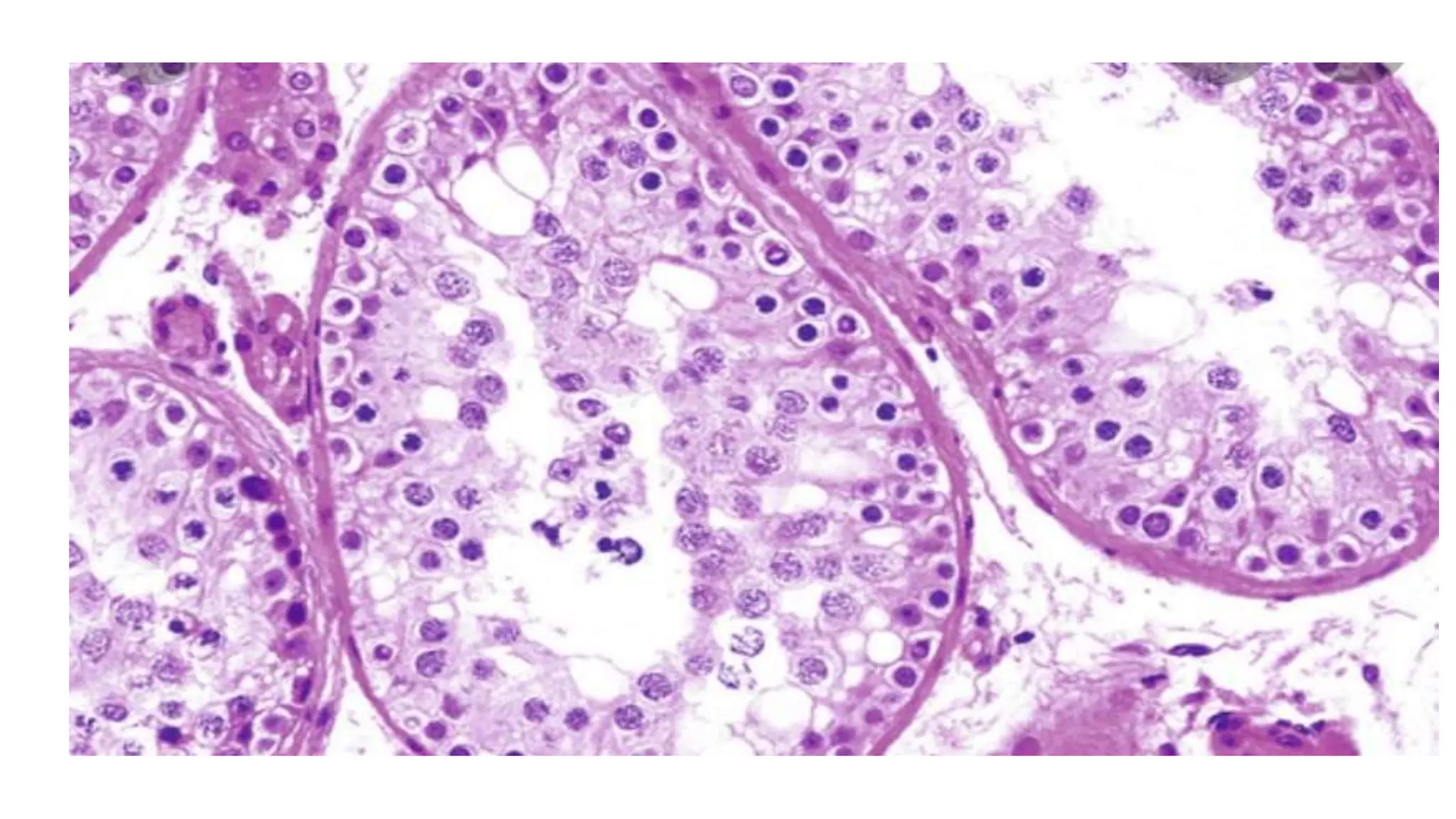 Approach to Testicular Biopsy.........pptx