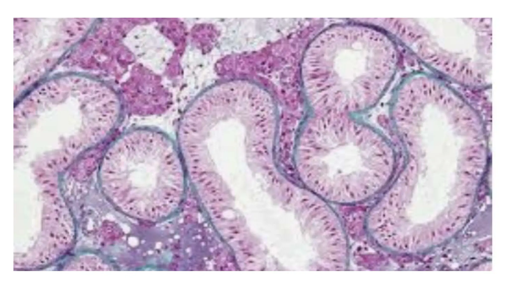 Approach to Testicular Biopsy.........pptx