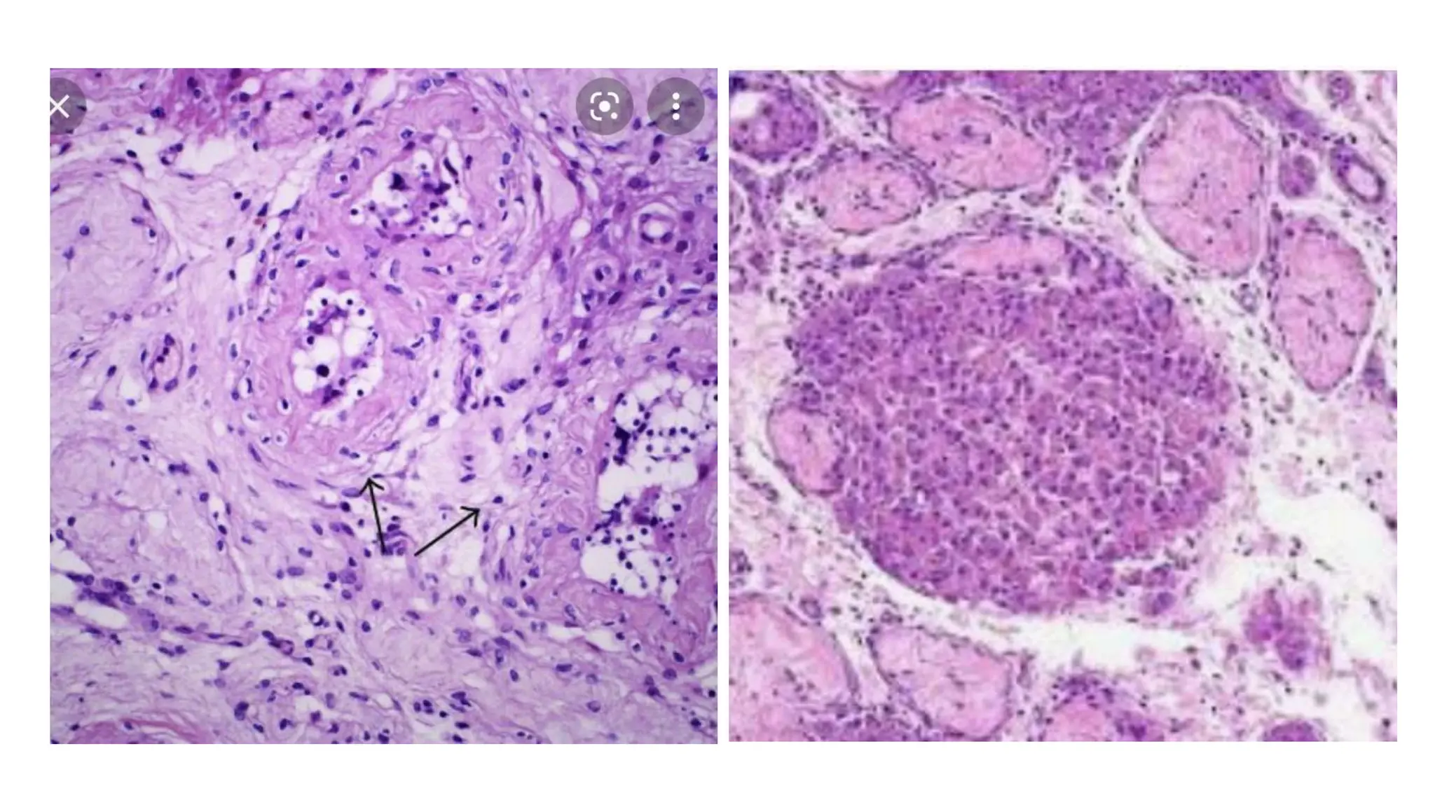 Approach to Testicular Biopsy.........pptx