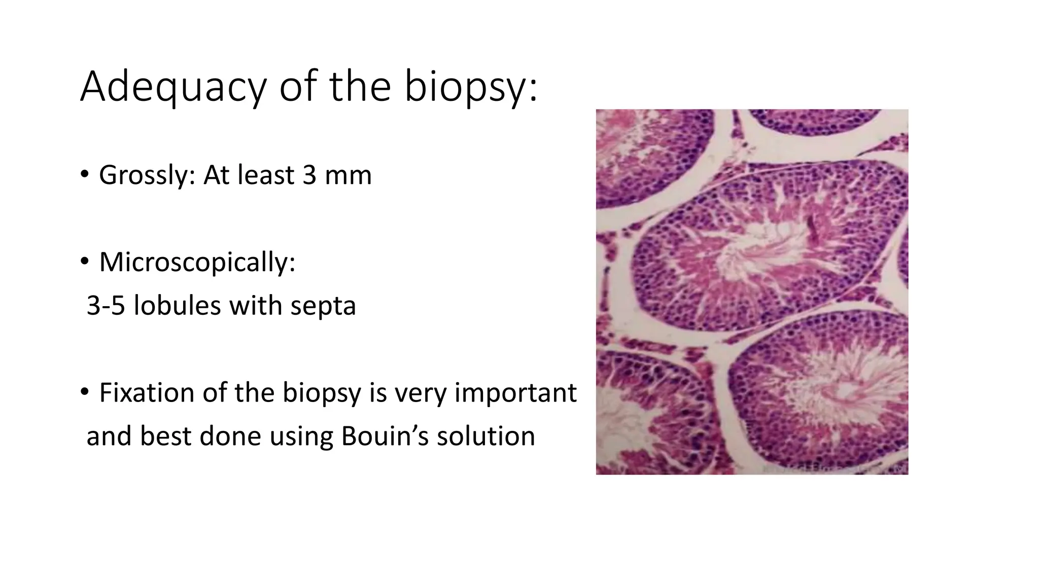 Approach to Testicular Biopsy.........pptx