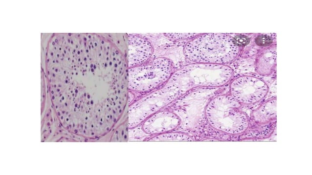 Approach to Testicular Biopsy.........pptx