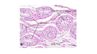 Approach to Testicular Biopsy.........pptx