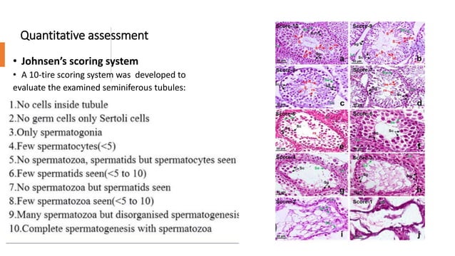 Approach to Testicular Biopsy.........pptx