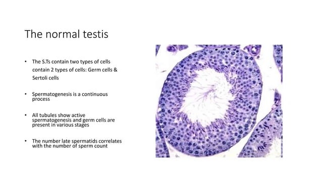Approach to Testicular Biopsy.........pptx