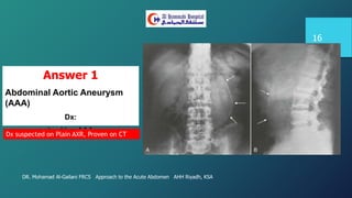Approach to the Acute Abdomen | PPT