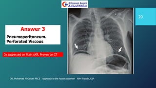 Approach to the Acute Abdomen | PPT