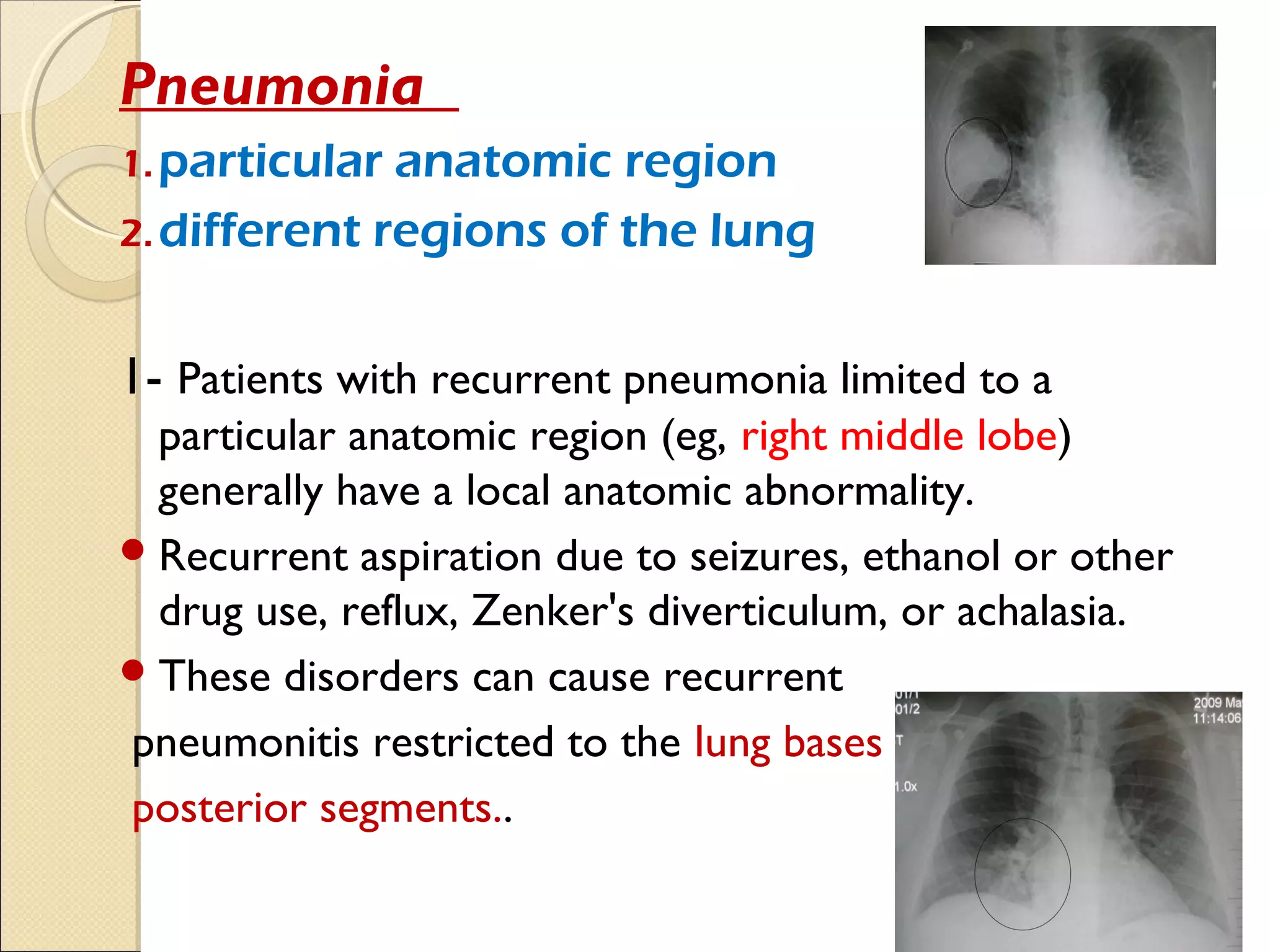 Approach to the adult with recurrent respiratory infections | PPT