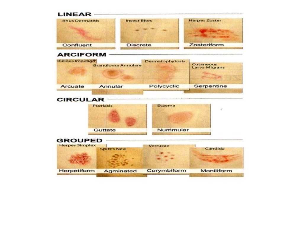 Approach to the child with rash