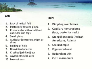 Approach to the dysmorphic child | PPTX