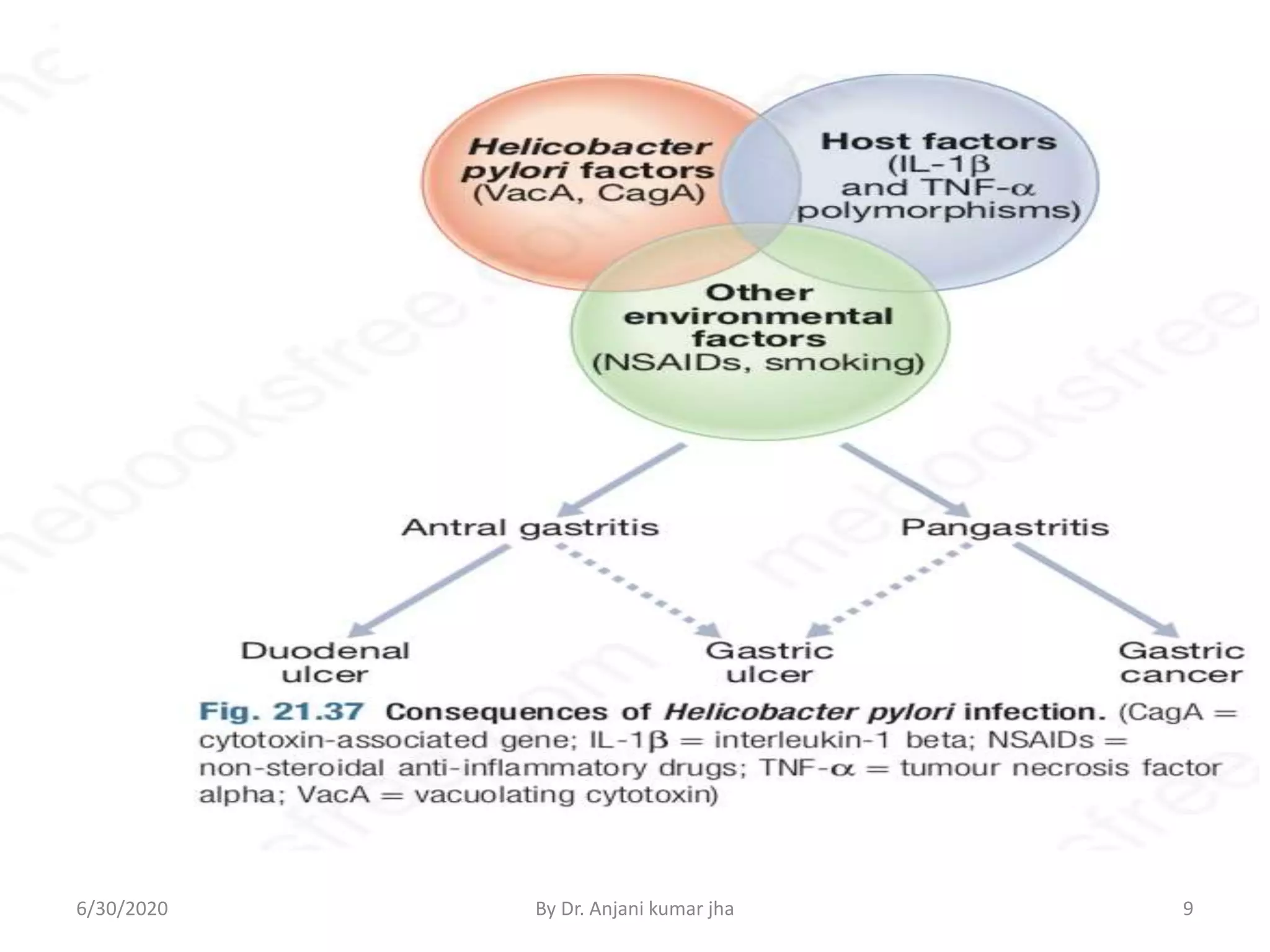 Approach to the management of peptic ulcer disease | PPTX