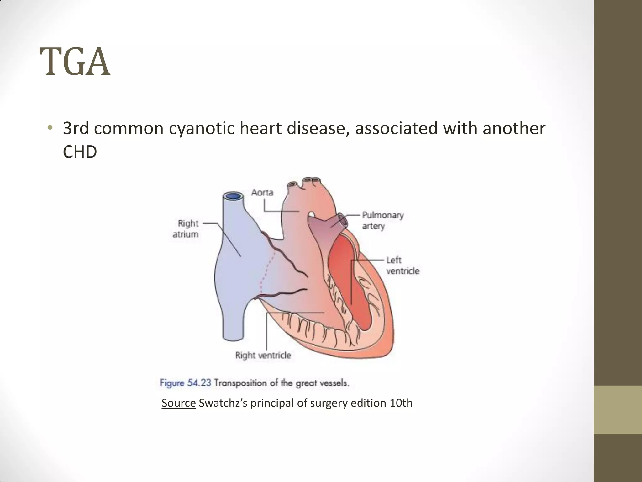 Approach to the neonatal cyanosis | PDF