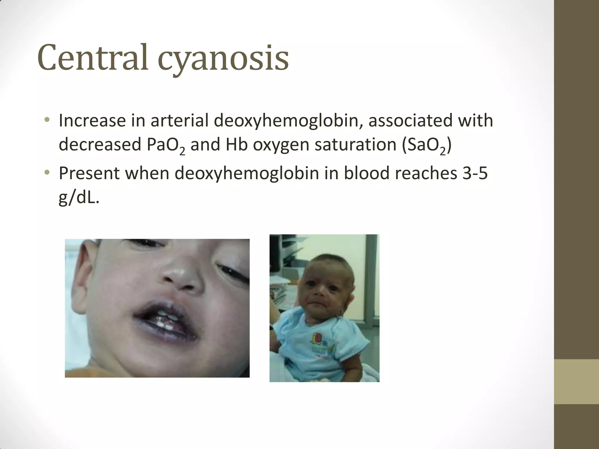 Approach to the neonatal cyanosis | PDF