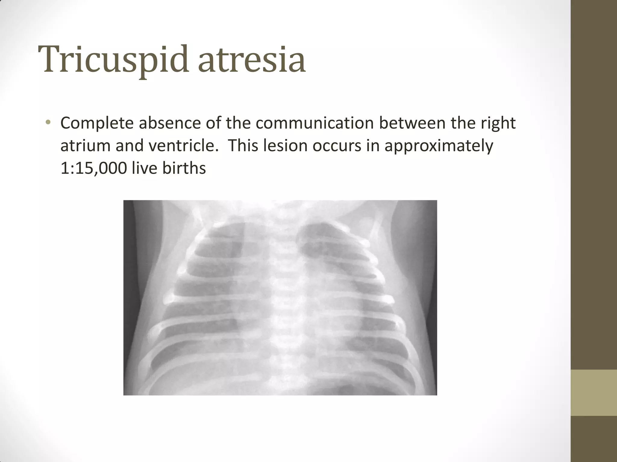 Approach to the neonatal cyanosis | PDF