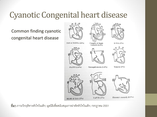 Approach to the neonatal cyanosis | PPT