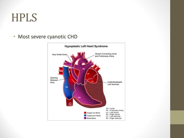 Approach to the neonatal cyanosis | PDF | Heart and Cardiovascular ...