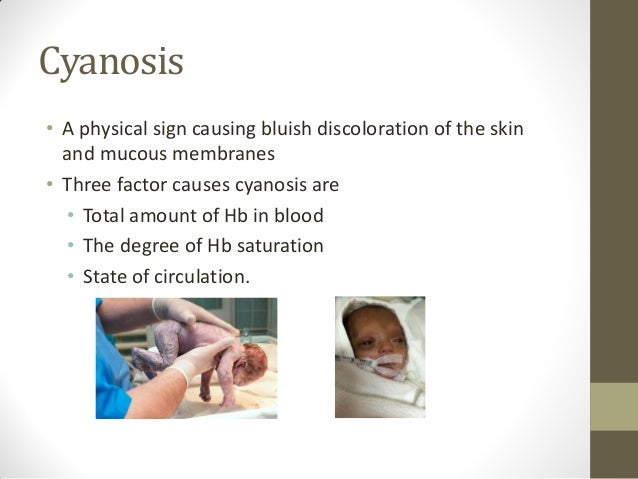 Approach to the neonatal cyanosis