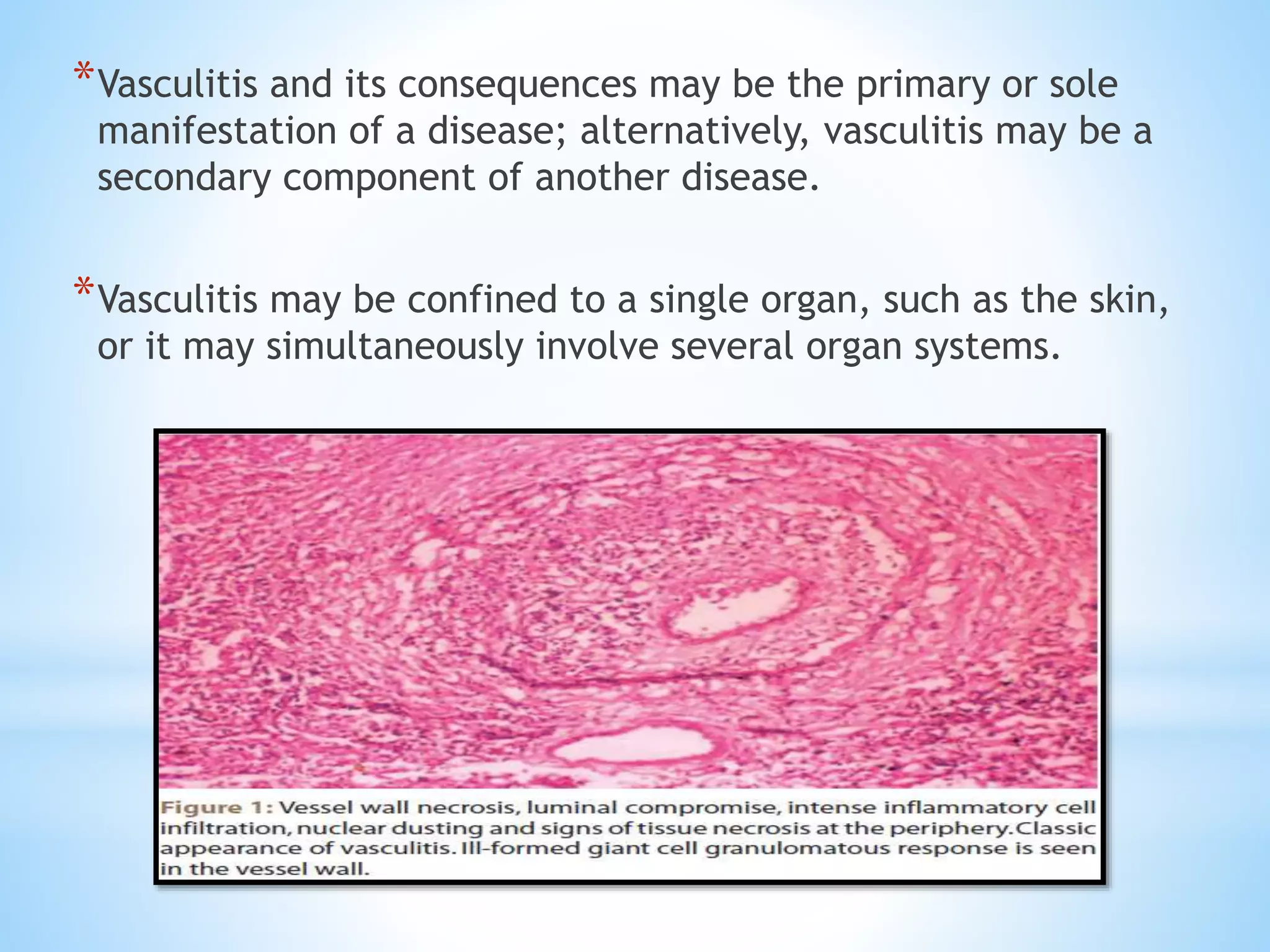 Approach to the patient vasculitis (2) | PPT