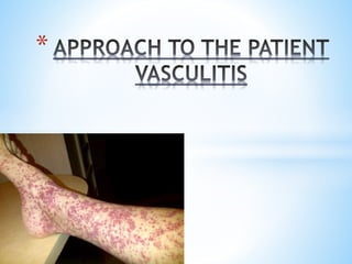 Approach to the patient vasculitis (2) | PPT