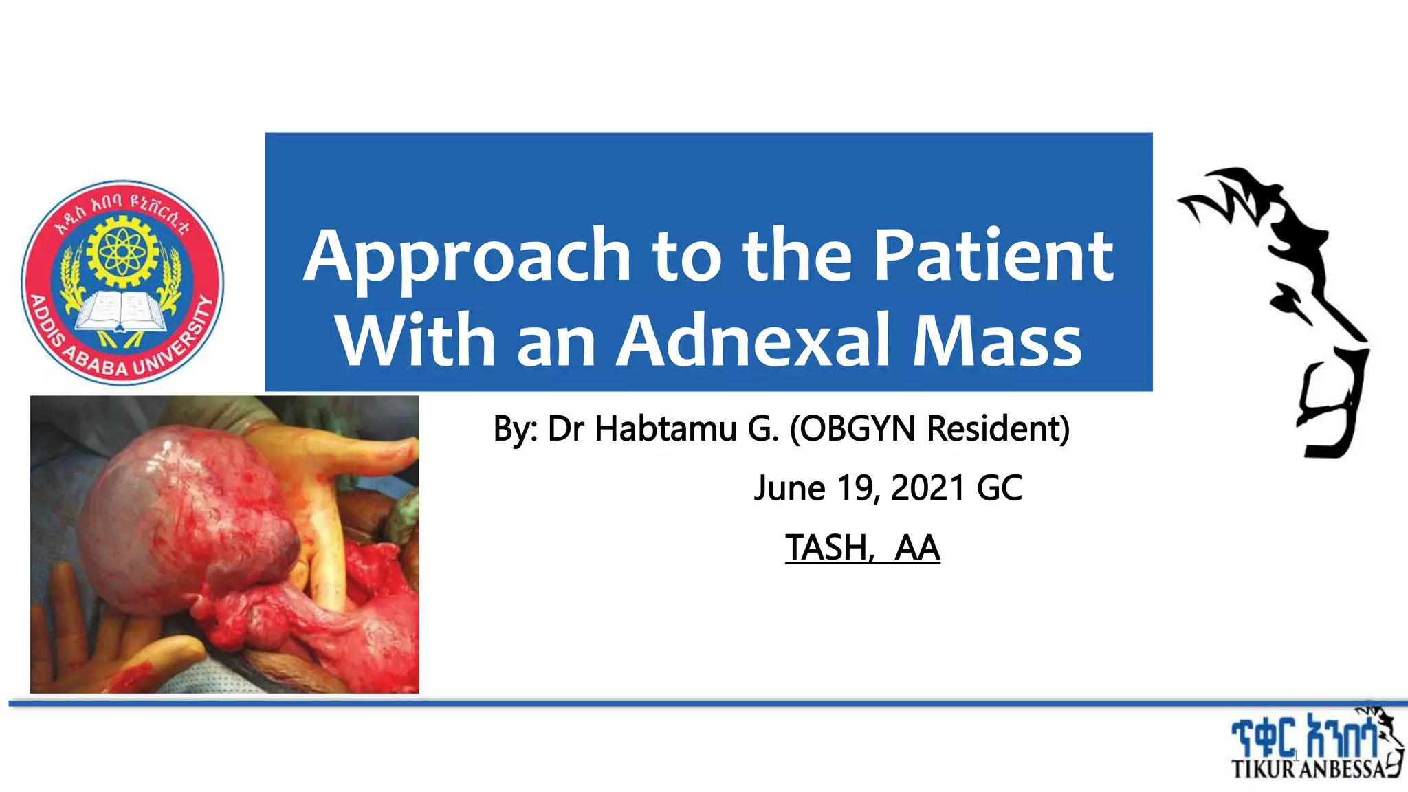 Approach To The Patient With An Adnexal Masspptx