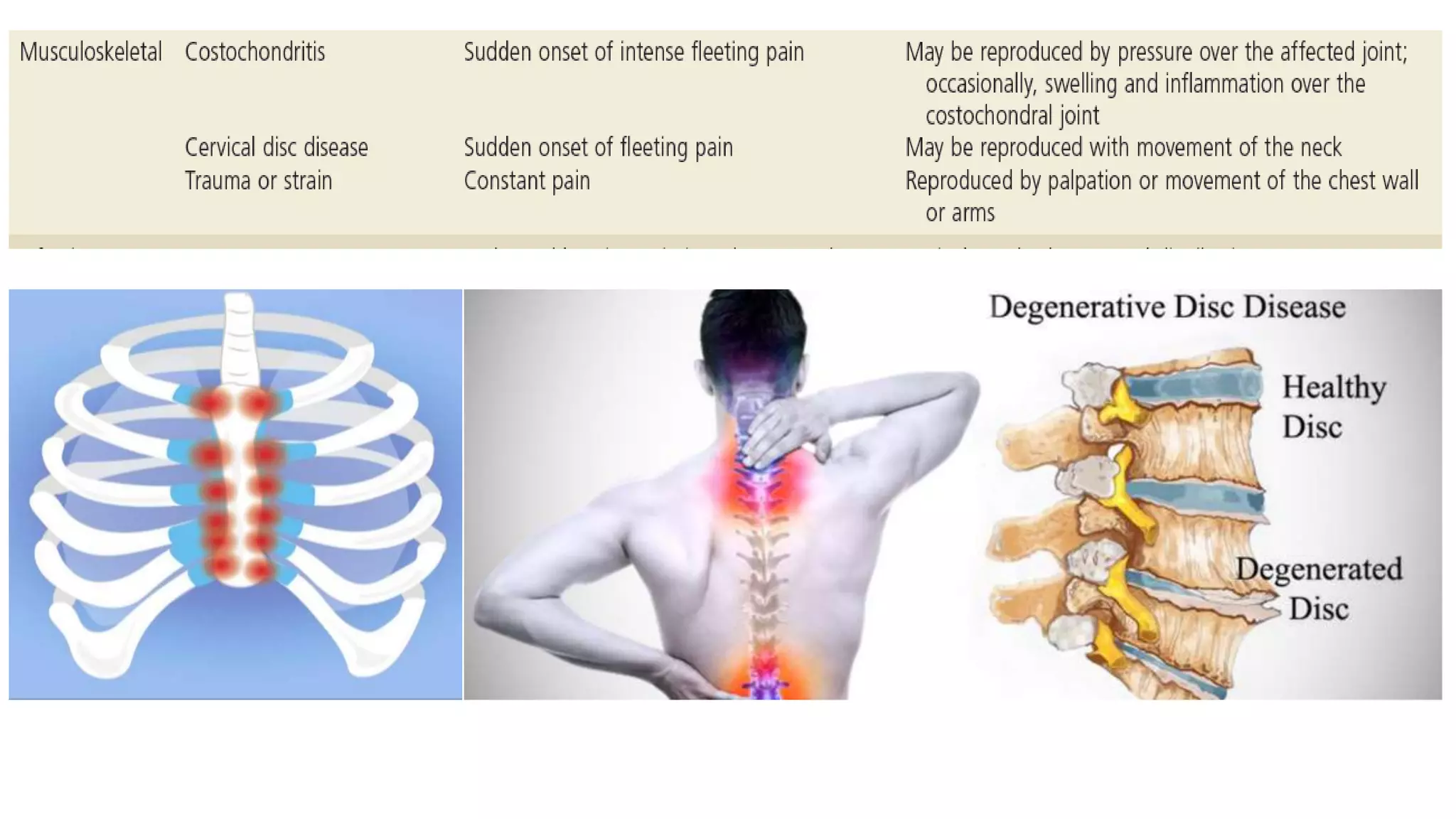 Approach to the patient with chest pain | PPT