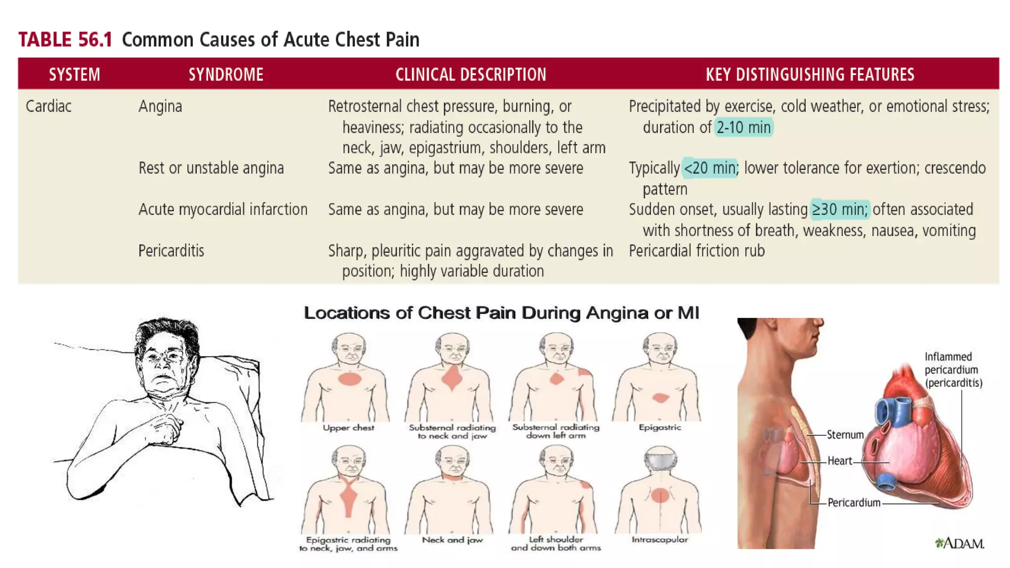 Approach to the patient with chest pain | PPT