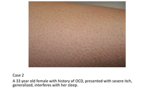 Approach to the patient with pruritus | PPTX