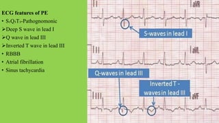 Approach to Thromboembolism II-1.pdf university of Zambia | PPT