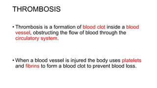Approach to thrombosis_gow_edit (1) | PPTX