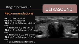 Approach to a thyroid nodule Draft 1.pptx