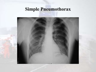 Approach to trauma- ATLS update by Dr.Damodhar.M.V | PPTX