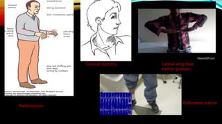 Approach to tremor | PPTX
