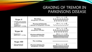 Approach to tremor | PPTX