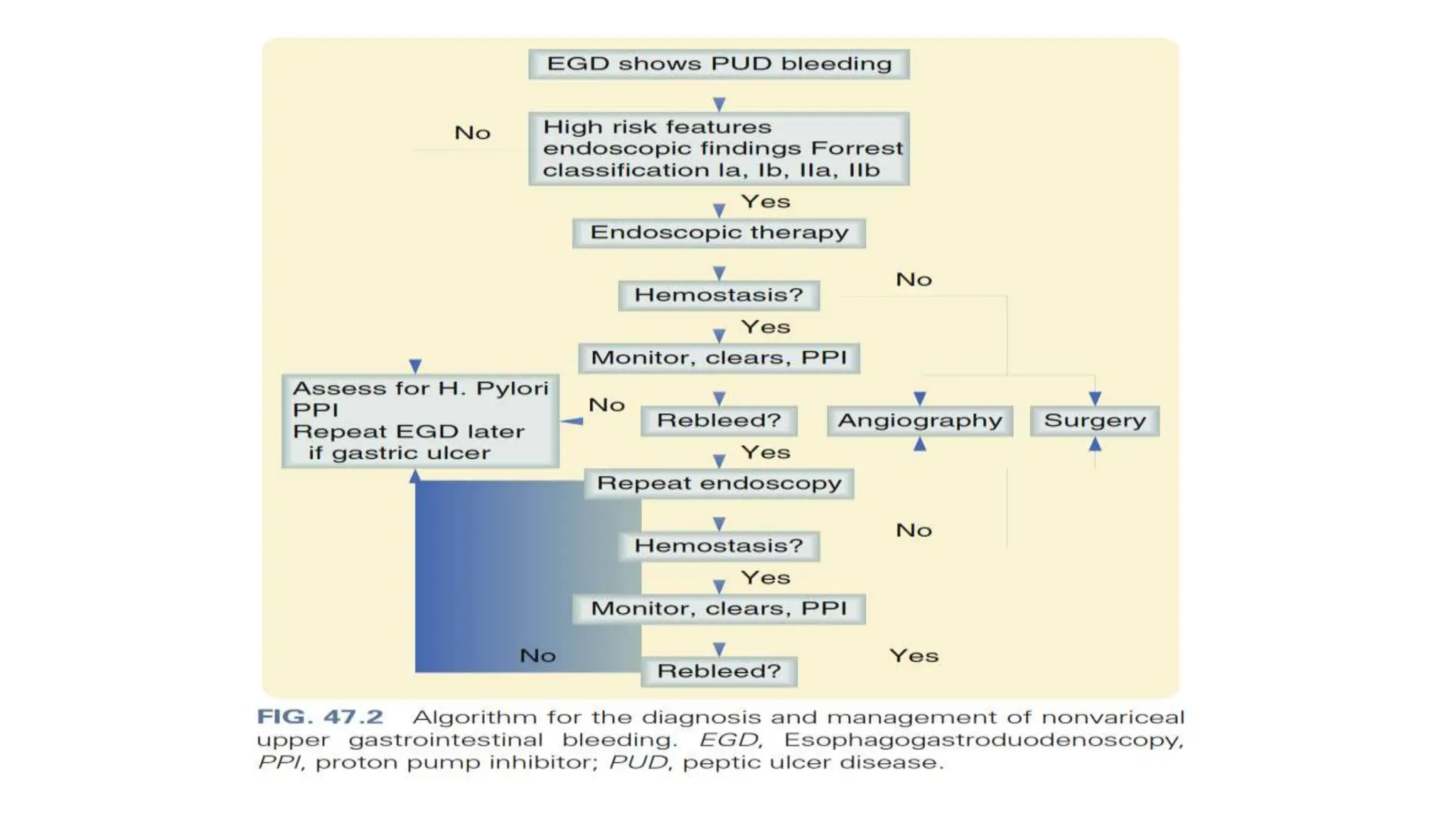 Approach to Upper GI Tract Bleed (UGI Bleed).pptx